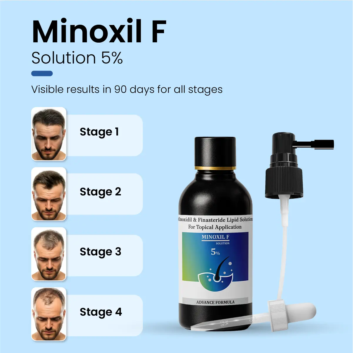 Minoxil F 5% Solution - Price, Uses, Benefits