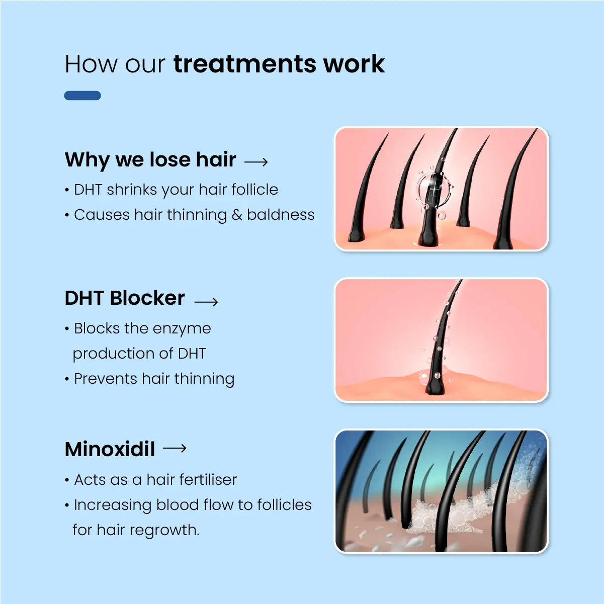 Minoxil F 5% Solution - Price, Uses, Benefits