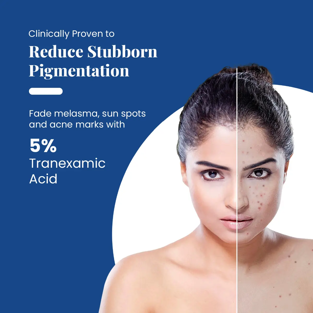 Tranexamic Acid 5% Face Serum - Under 300